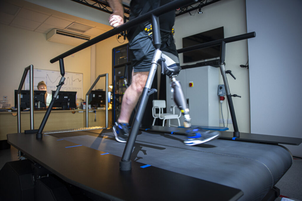 Prosthetic Treatment | Amputation Rehabilitation | RNOH